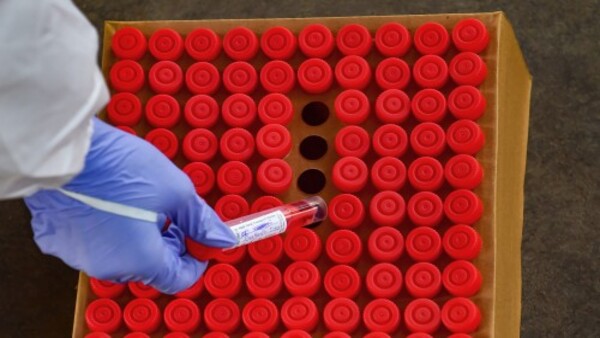 ওমিক্রনের নতুন সাব ভেরিয়েন্ট XXB দ্রুত সংক্রমণ ঘটাচ্ছে সিঙ্গাপুরে ...