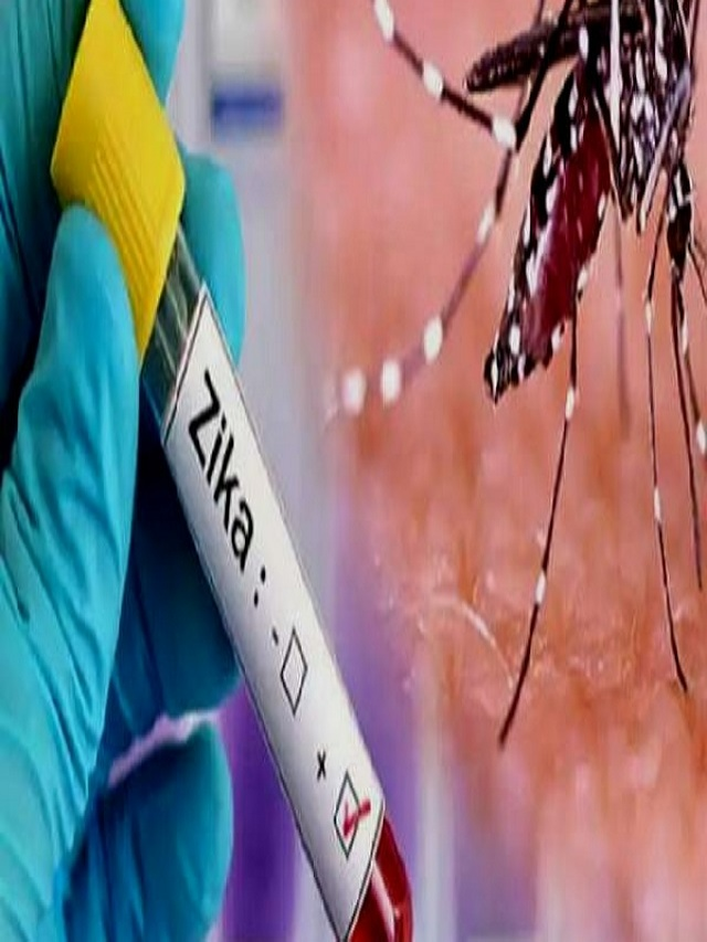 Zika Virus: जीका वायरस लक्षण, कारण और बचाव