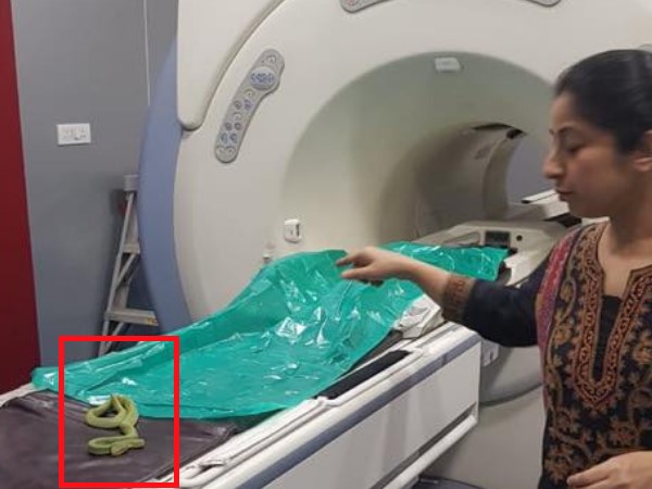 लाठी मार तोड़ी जहरीले सांप की रीढ़ की हड्डी, डॉक्टर ने MRI की मदद से ...