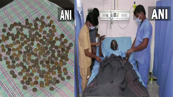 Doctors remove 187 coins weighing 1.5 kg from 58-year-old man suffering ...