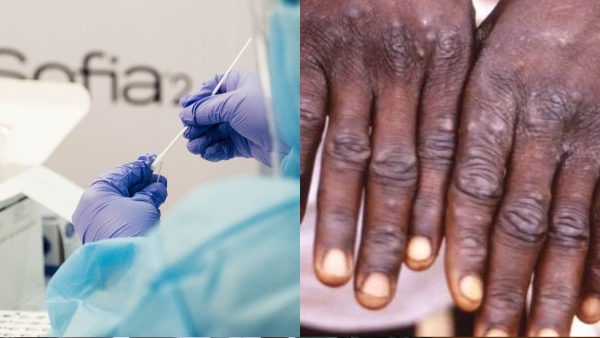 India Launches Home-Grown RT-PCR Kit For Monkeypox Detection - Oneindia News