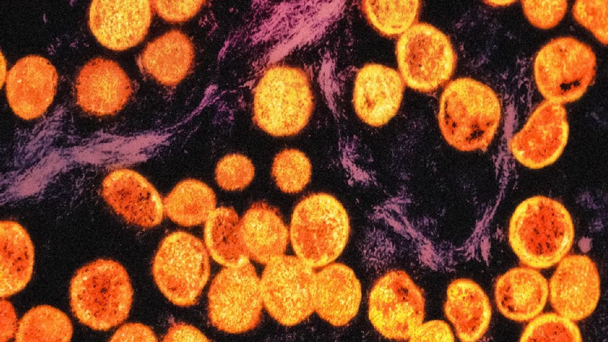 Peshawar Becomes Mpox Epicenter: Pakistan's Case Count Hits Five ...