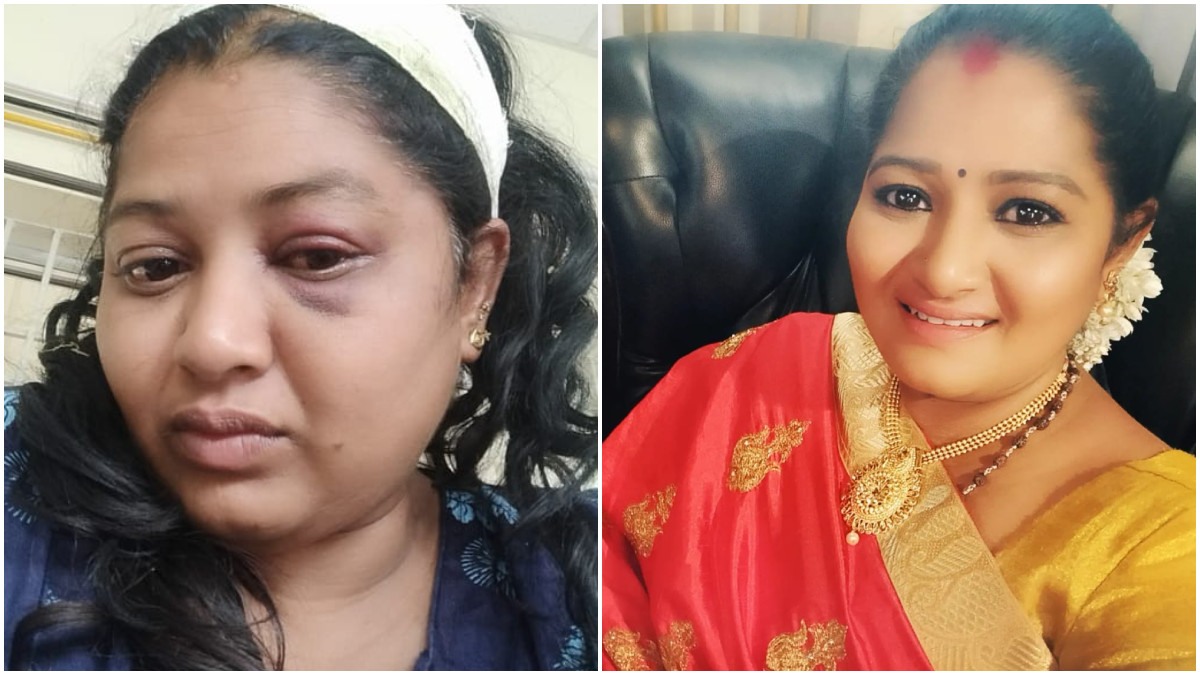 ಶಿವಮೊಗ್ಗ: ಜಮೀನು ವಿವಾದ, ಕೆಂಪೇಗೌಡ ಚಿತ್ರದ ನಟಿಯ ಮೇಲೆ ಹಲ್ಲೆ | Assault On Kannada Actress Anitha Gowda ...