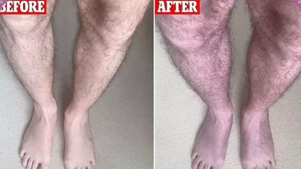 Corona updates: ಕೊರೊನಾ ರೋಗಿಯ ಕಾಲು "ನೀಲಿ ಬಣ್ಣ'ಕ್ಕೆ ತಿರುಗುವ ಲಕ್ಷಣ ಪತ್ತೆ ...