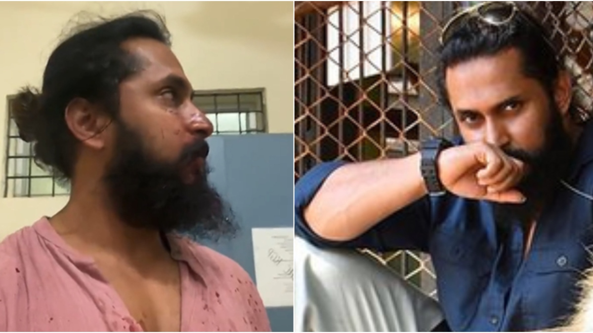 Chetan Chandra: ನಟ ಚೇತನ್‌ ಮೇಲೆ ಹಲ್ಲೆ, ಮುಖ ಕಿತ್ತು ಹೋಗುವ ಹಾಗೆ ಹೊಡೆದ ಕಿಡಿಗೇಡಿಗಳು | Assault On ...