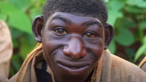 Rwanda: 23 year old youth now returned to his normal life after running ...