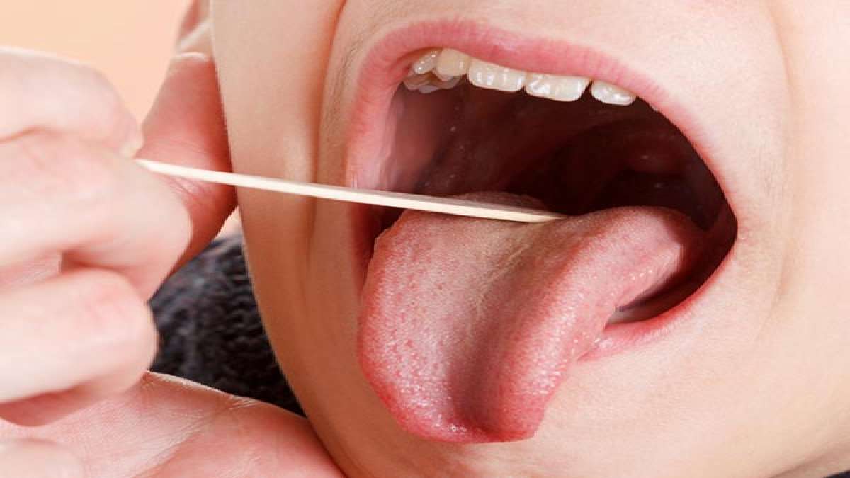 Does Oral Sex Cause Throat Cancer Here Is What Report Says Goes Viral