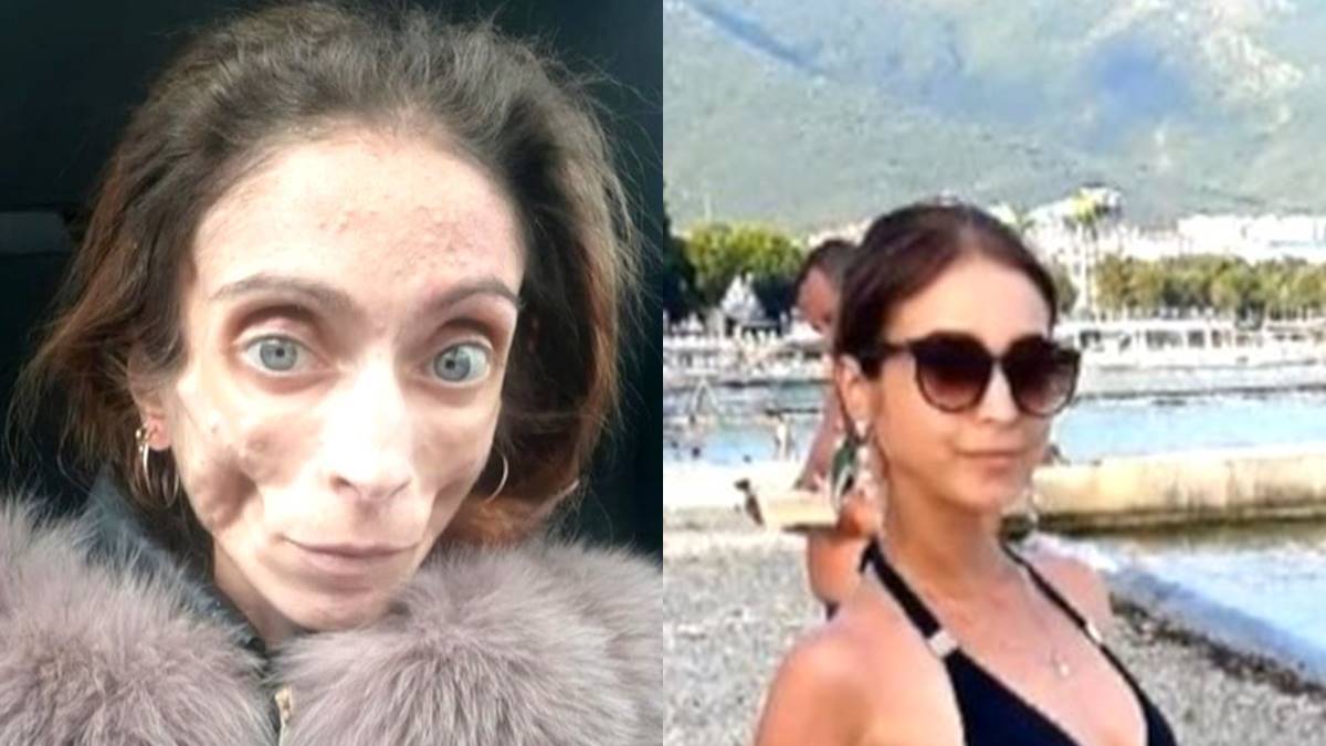 Viral: Yana Bobrova from Russia decided to lose weight after being ...