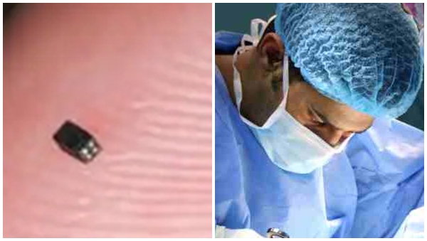 World's Smallest Camera OV6948: Here's How It Works, Features, Price, and more - Malayalam Oneindia