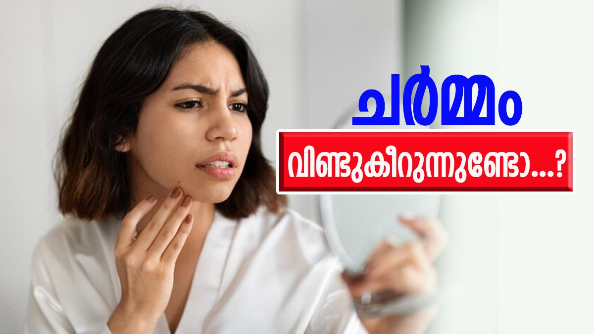ചർമ്മം വരണ്ട് തുടങ്ങിയോ ചൊറിച്ചലുമുണ്ടോ പരിഹാരമുണ്ട് വീട്ടിൽ തന്നെ