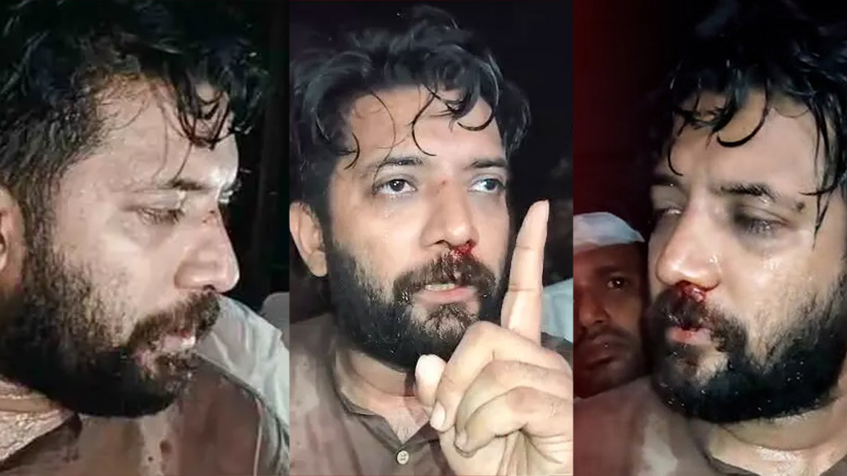 Shafi Parambil MP Got Injured In CPM-UDF Clash In Perambra ...