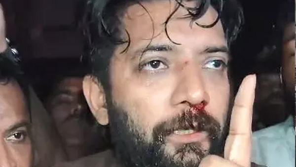 Shafi Parambil MP Got Injured In CPM-UDF Clash In Perambra ...