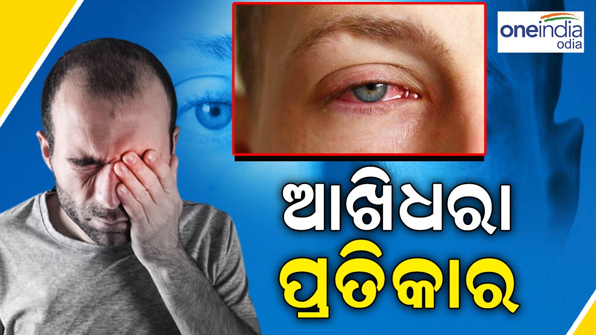 ମାଡ଼ି ଚାଲିଛି ଆଖିଧର ରୋଗ: ଜାଣନ୍ତୁ, କେମିତି କରିବେ ଏହାର ପ୍ରତିକାର ...