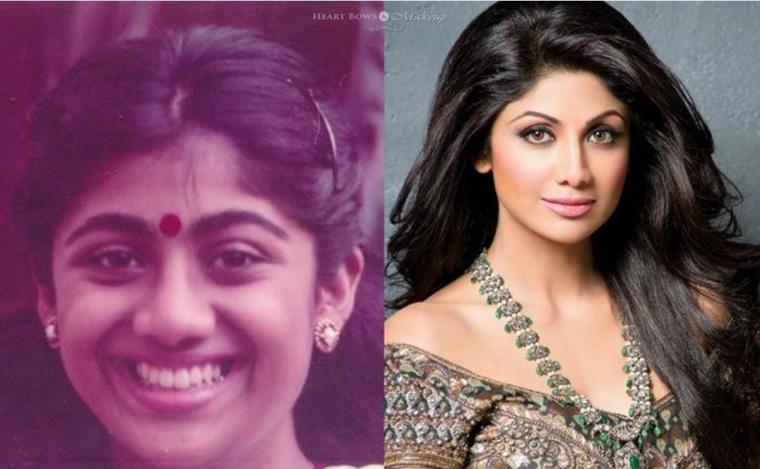 PHOTOS : பிளாஸ்டிக் சர்ஜரி மூலம் அழகுக்கு அழகு சேர்த்த டாப் 10 ...