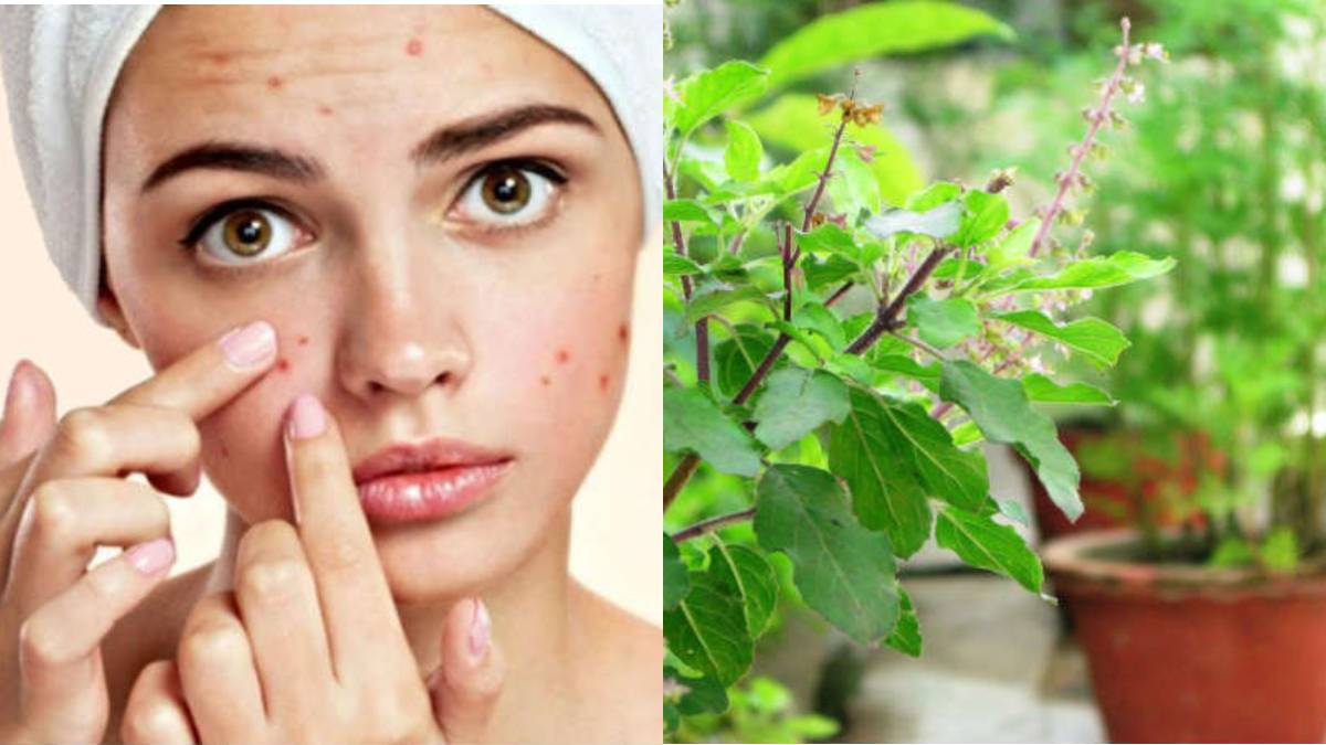 முகப்பரு பிரச்சனையா? வீட்டில் இருக்கும் இந்த ஒரு செடி போதும்! | Skin ...