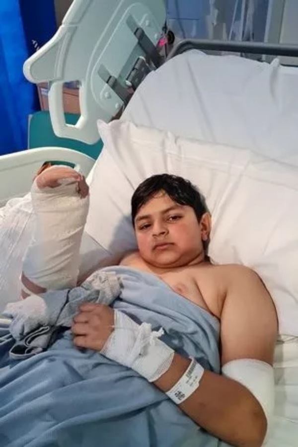 12 வயது சிறுவனை கொடூரமாக தாக்கிய தெரு நாய்.. இறந்துவிட்டதாக கலங்கிய ...