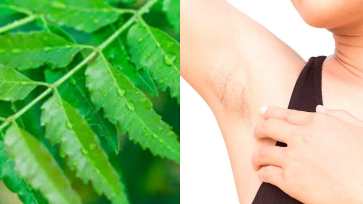 அக்குளில்.. கொப்புளம் வந்துவிட்டதா.. அக்குள் சூடு கட்டிகளை கரைக்க "இது ...