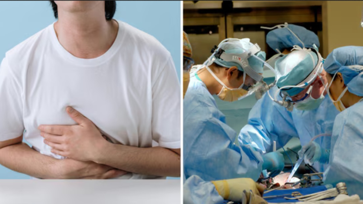 46 வயது ஆணுக்கு இரனியா ஆபரேஷன் செய்த போது மருத்துவர்கள் அதிர்ச்சி ...