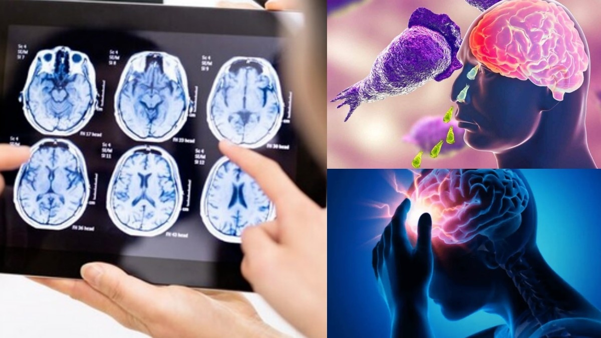 மூளையை தின்னும் அமீபா மரணங்கள்.. ஒருவரிடம் இருந்து மற்றவருக்கு பரவுமா? தமிழக அரசு முக்கிய அலர்ட் ...