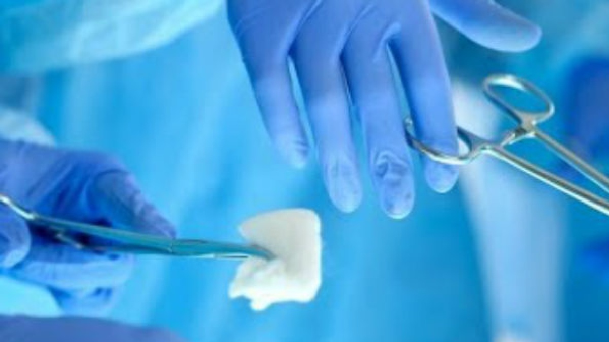 పురుషాంగం పునఃసృష్టి.. భాగ్యనగరం డాక్టర్ల అద్భుతం | Penis ...